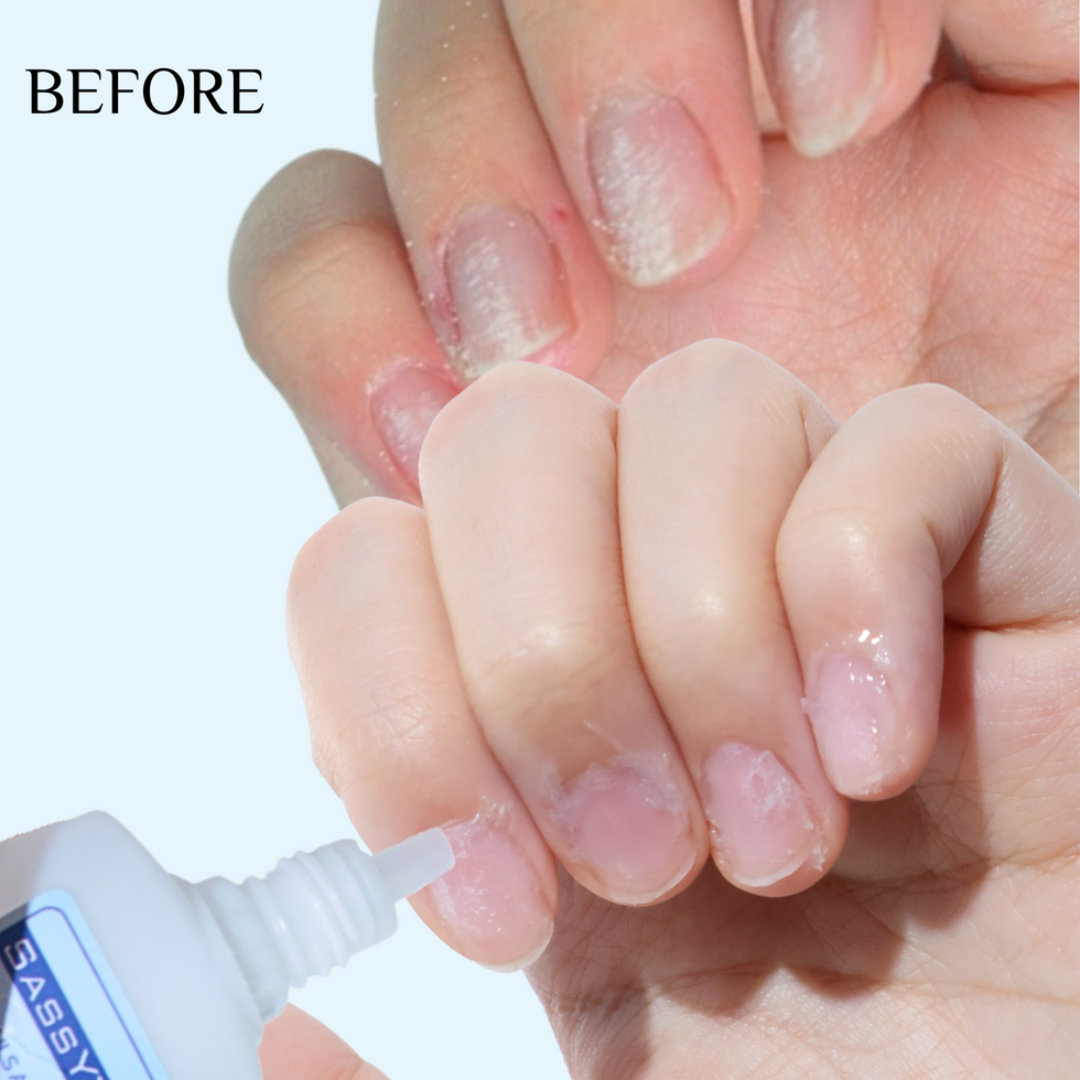 SassyTip Liquid Blade Cuticle Remover – Sassytip
